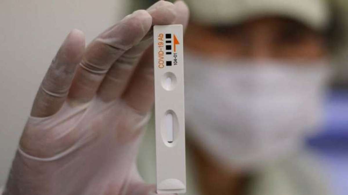 Sensor to rapidly detect coronavirus infection developed – India TV