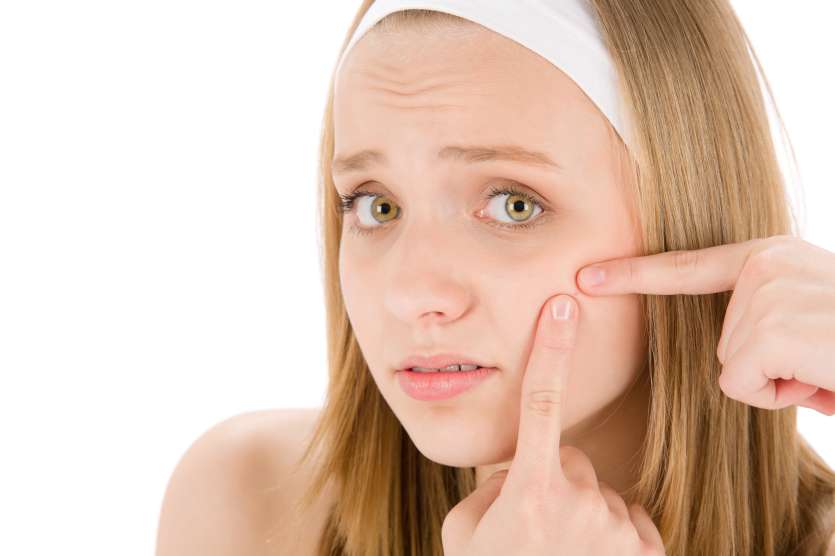 Get rid of acne with these 5 effective tips