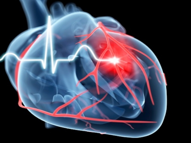 3D virtual heart tool to predict risk of sudden cardiac death ...