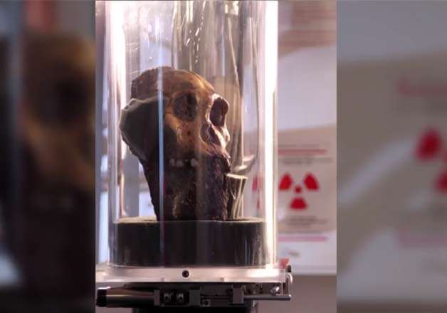 Here's the 1.7 million-year-old human fossil suffering from cancer ...