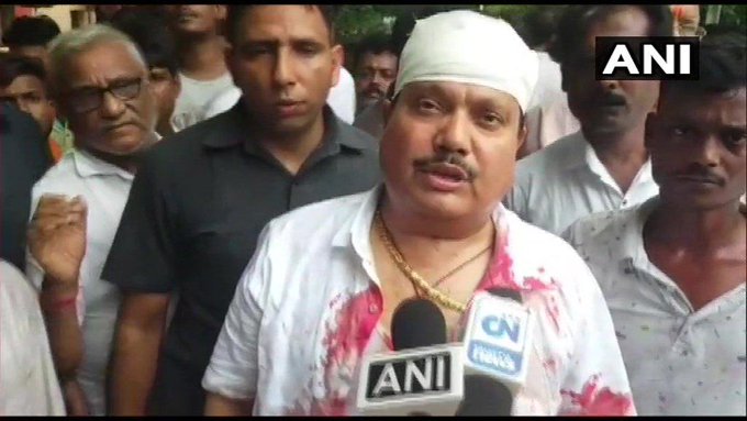 BJP MP Arjun Singh suffers head wound in clash with police | India News – India TV