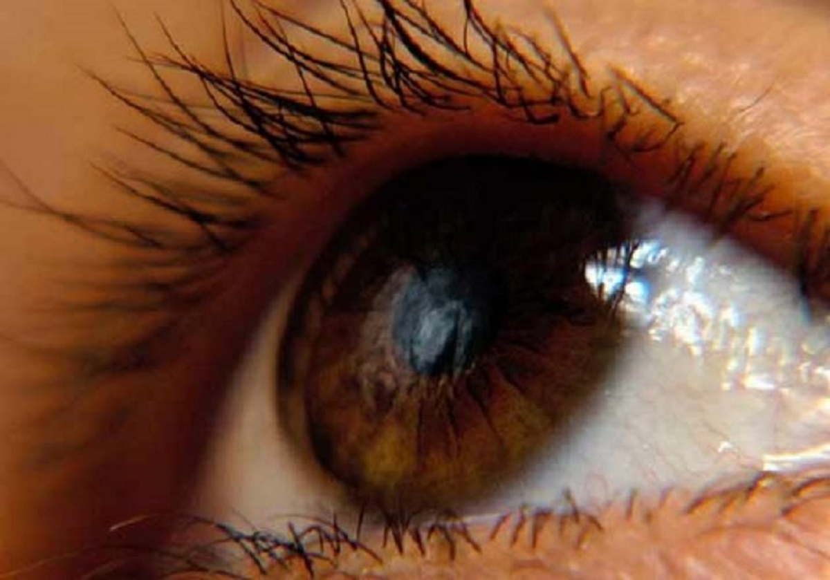 Mahadalit woman's eye attempted to be gouged out in Bihar | Crime News ...