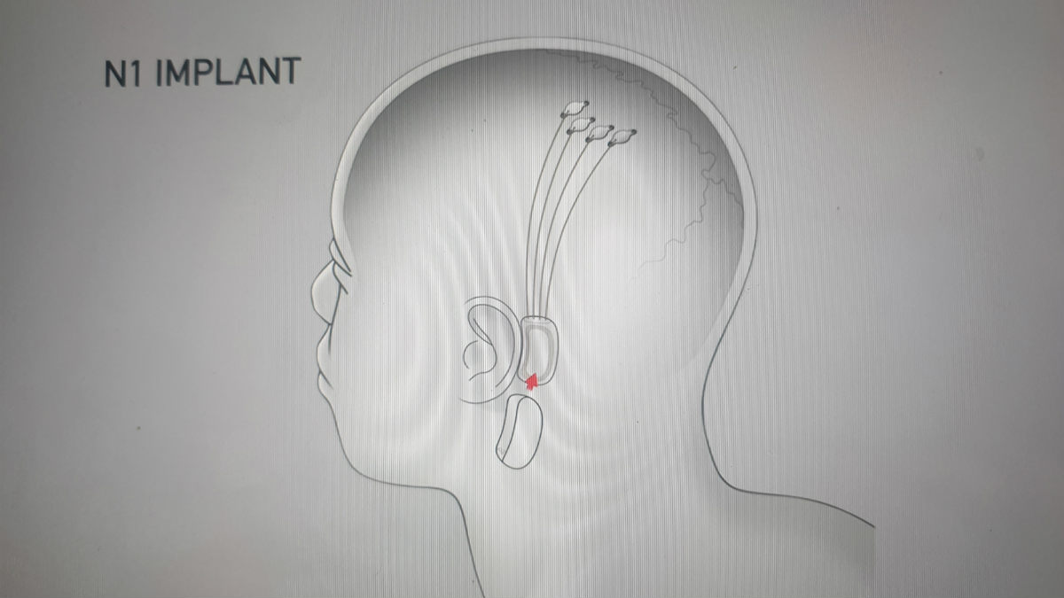 Elon Musk's startup Neuralink set to demonstrate working device ...