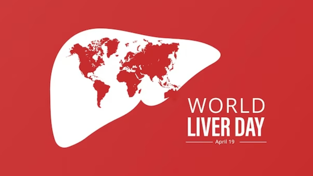 World Liver Day 2024: Expert explains the link between fatty liver and ... World Liver Day 2024: Expert explains the link between fatty liver and ...