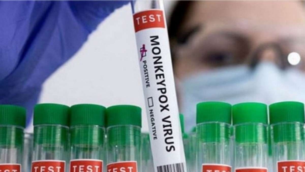 AIIMS Delhi issues protocol for treatment of suspected monkeypox ...