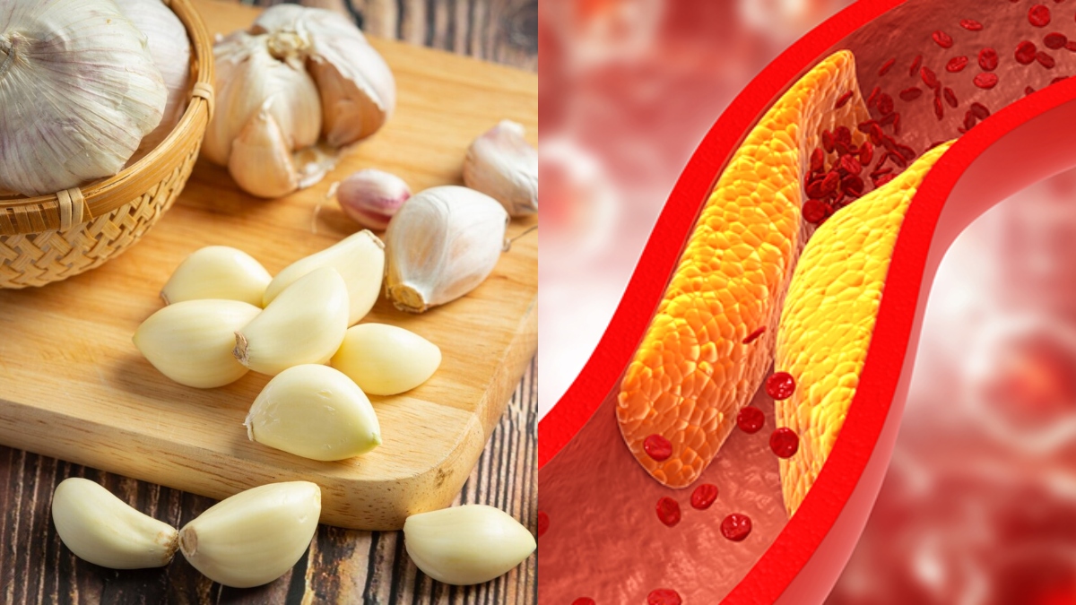What is the role of raw garlic in cholesterol management? Know here ...