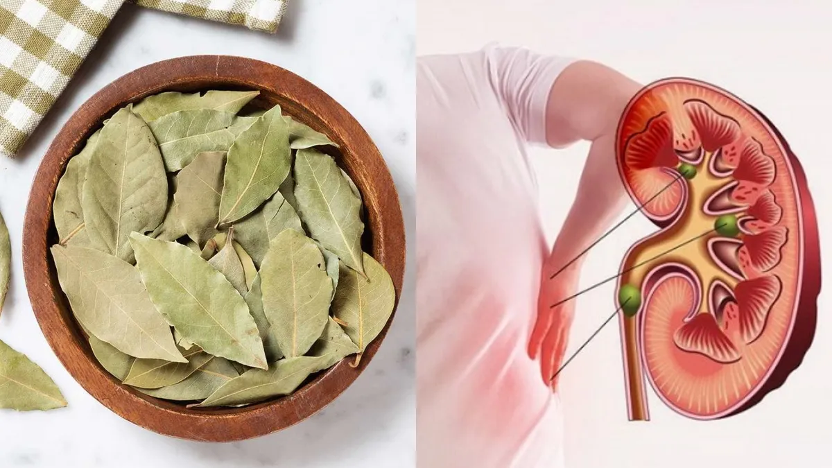 Using THIS dry leaf can break Urate Crystals deposited in joints and ...