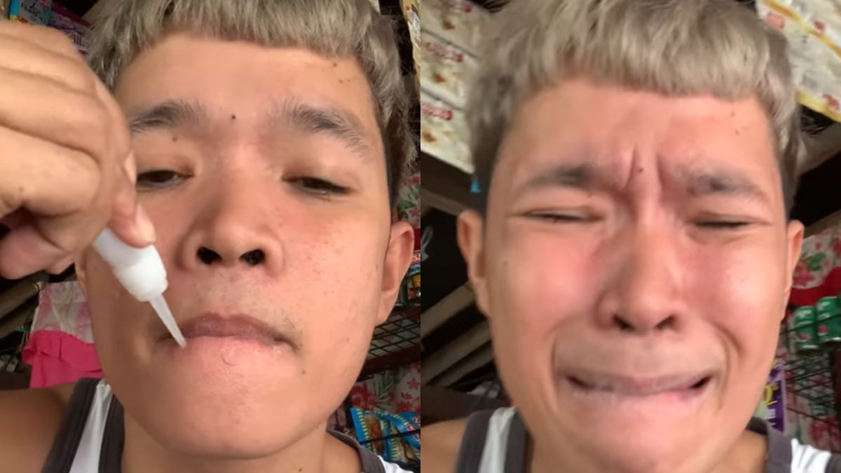 Stunt goes wrong after man seals his lips with superglue; watch viral ...