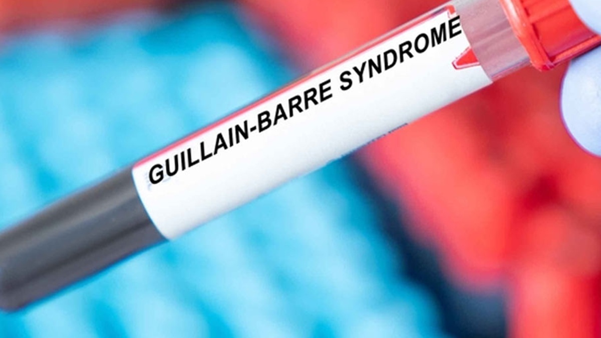 First GBS death reported in Kerala as 58-year-old dies of Guillain-Barre Syndrome in Kochi ...