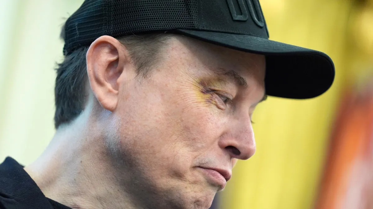 Musk appears with bruise near right eye at Oval Office, says his son X ...