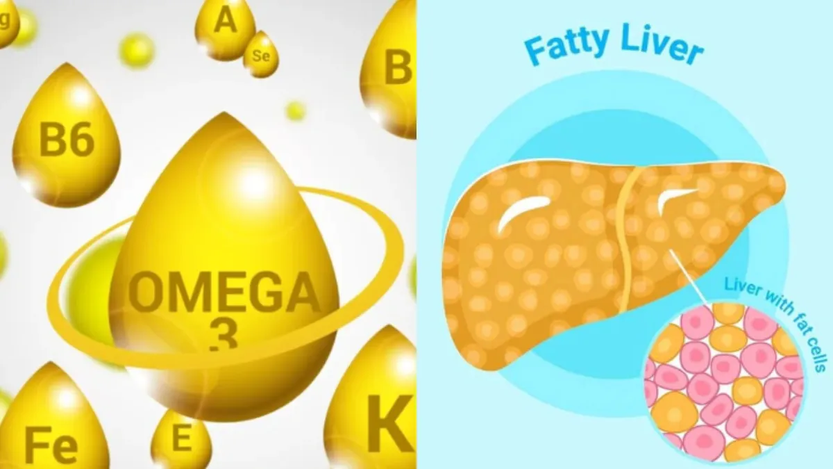 Omega-3 fatty acids can help cure fatty liver issues, know other ...