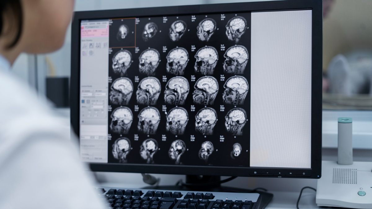 COVID-19 pandemic, lockdowns aged the brain 5.5 times faster, even ...