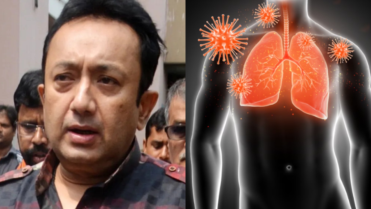 COPD and pneumonia can be deadly: What Joy Banerjee's case teaches us | Health News – India TV