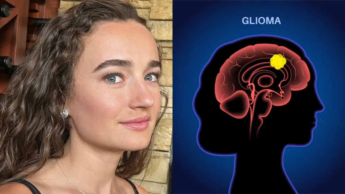 Kelley Mack's death puts focus on CNS glioma: What you should know ...
