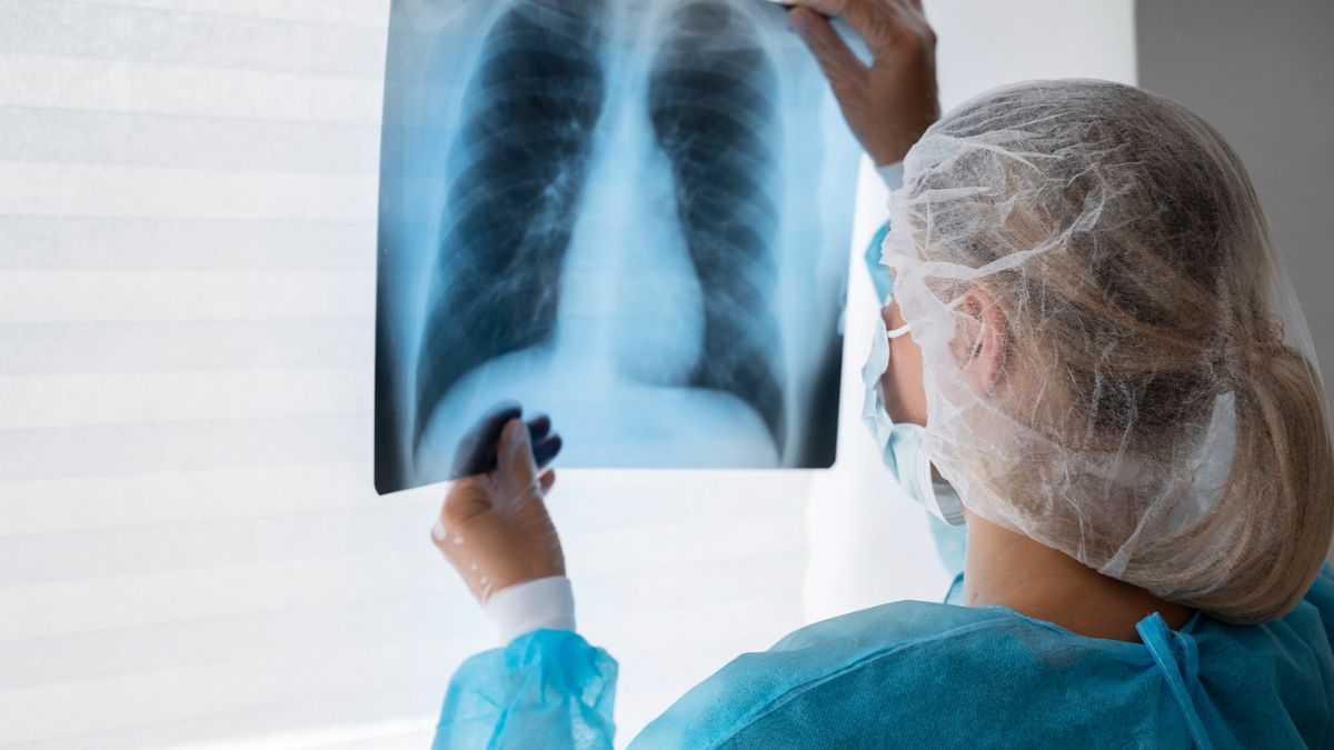 Which TB test do you need? Sputum, Blood, QFT-Gold, CBNAAT and other ...
