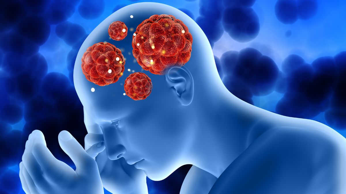 Brain-eating amoeba outbreak: Kerala confirms 67 cases, 18 deaths so ...