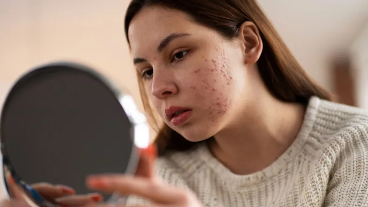Pollution leads to acne, dryness and dullness: Expert explains how to ...