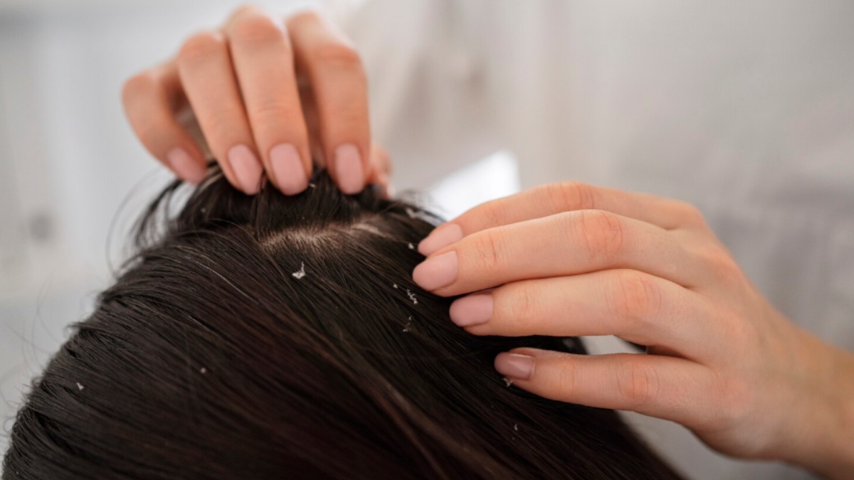 7 everyday habits that cause itchy, flaky scalp, according to a Hair ...