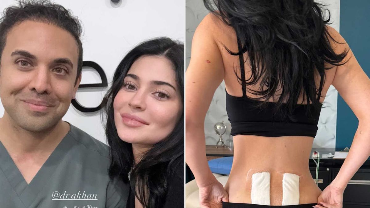 Kylie Jenner undergoes stem cell therapy; benefits, risks and who ...