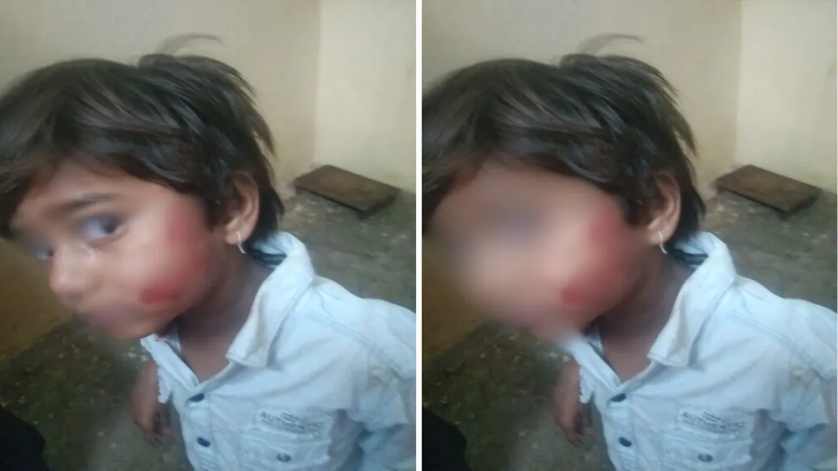 Stray dog attacks 5-year-old girl on street in Hyderabad, CCTV captures ...