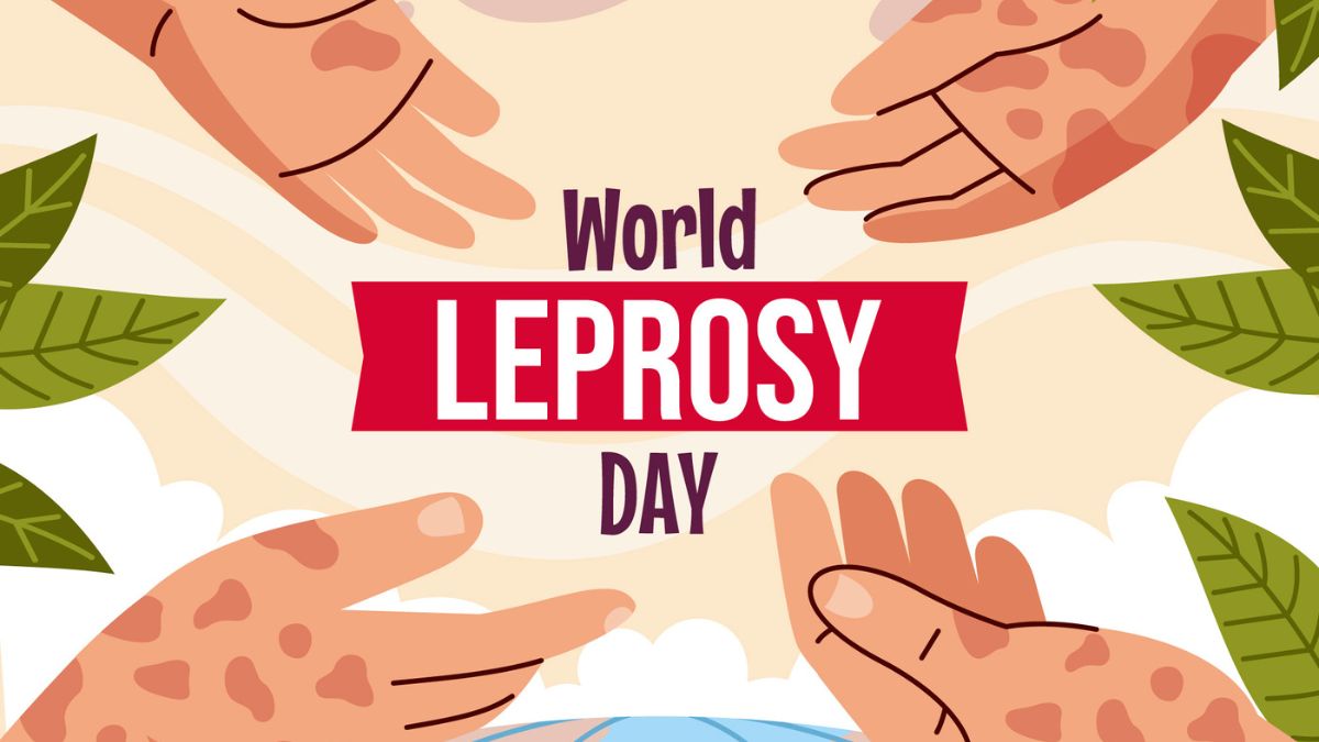 World Leprosy Day: Is leprosy contagious? Dermatologist breaks down the ...