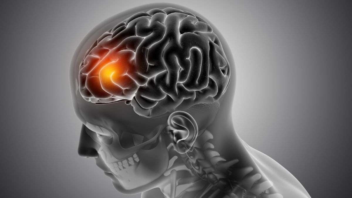 Did you know poor sleep can shrink your brain? Doctor highlights 5 ...