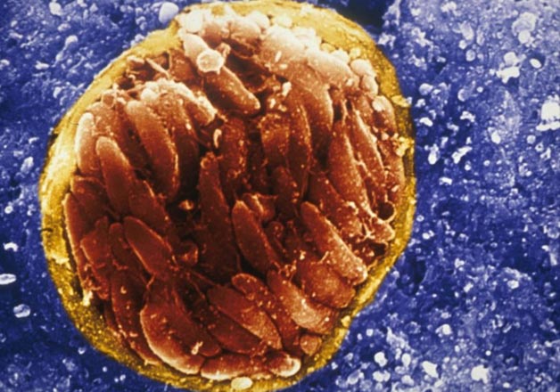 Brain parasite could be behind road rage | Lifestyle News – India TV