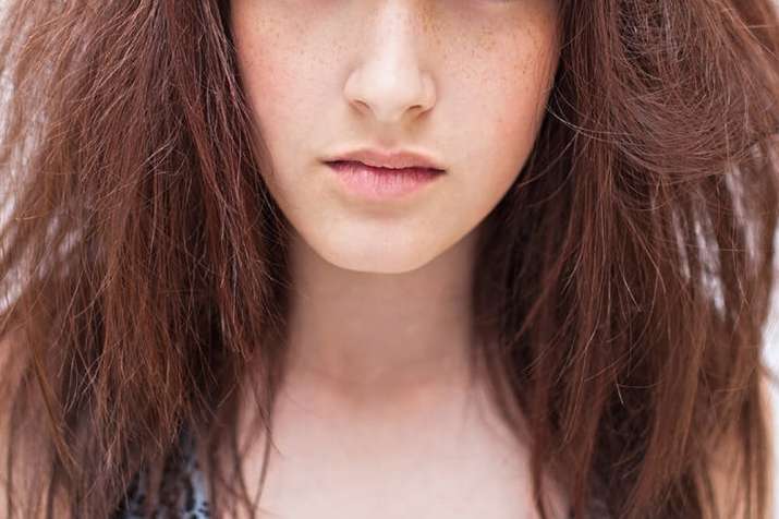 5 most common hair problems with easy and effective solutions | Beauty ...