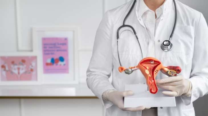 Know All About Ovarian Cysts That Develop During Menstruation Know