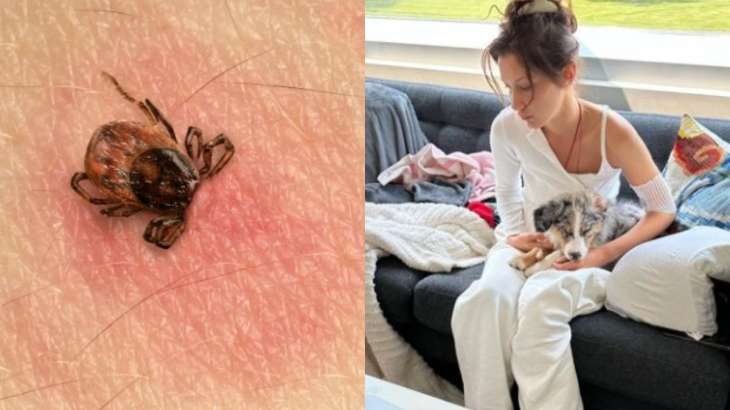 Lyme Disease: Know symptoms and causes of the disease that Bella Hadid suffering from past 15 ...