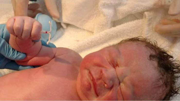 Baby born with IUD in hand? Epic fail goes viral on internet