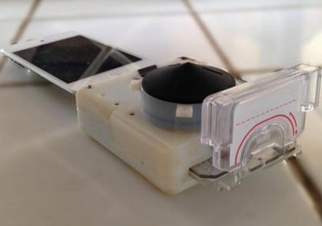 Low-cost smartphone accessory to diagnose HIV in 15 minutes | India ...