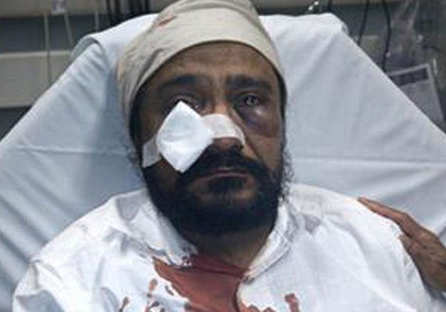 Sikhs feel vulnerable, join with Muslims to combat backlash | World News – India TV