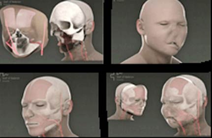 World's First Leg Transplant In Spain This Summer | World News – India TV