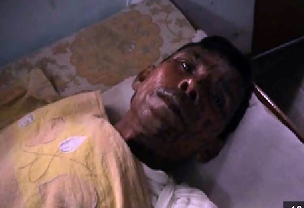 Delhi Man Throws Pail Of Acid At Five Senior Citizens, One Critical ...