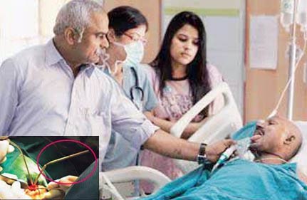 Delhi Doctors Save Worker After Rod Pierces His Brain | India News ...