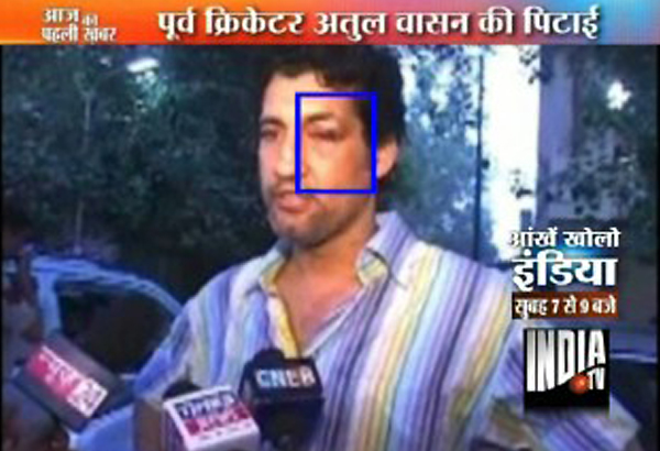 Minister's Bodyguards Assault Atul Wassan | India News – India TV