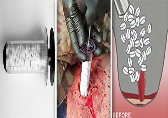 Amazing invention: Pocket sized gadget that can seal a gunshot wound in ...