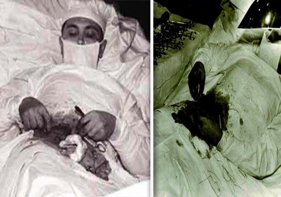 Incredible: Meet the Russian doctor who removed his own appendix in ...