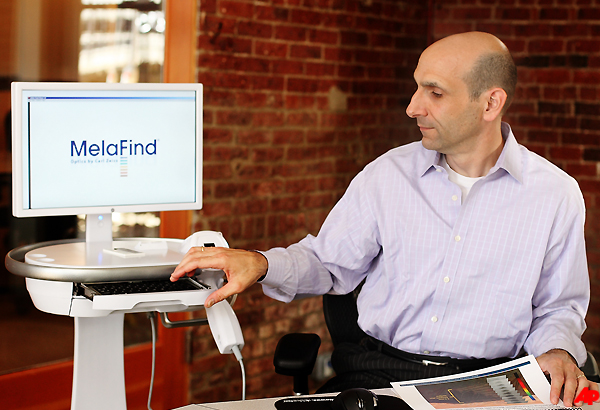 New Device MelaFind To Detect Melanoma Skin Cancer | World News – India TV