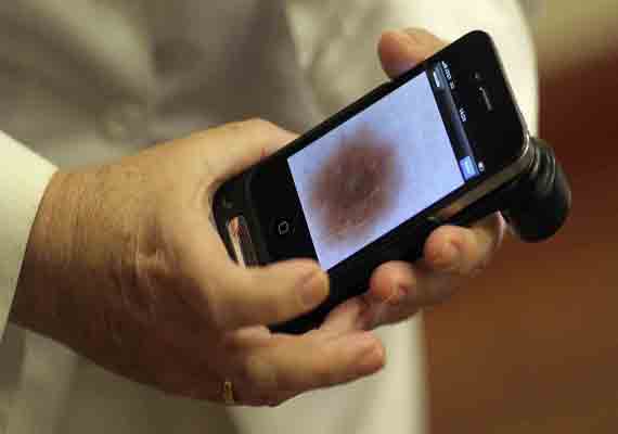 IIT students develop new mobile app to detect skin cancer | India News ...